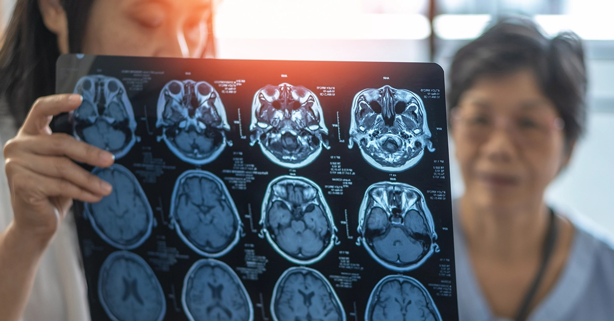 Why the Neuroscience Resurgence—Especially in Alzheimer’s and Parkinson ...